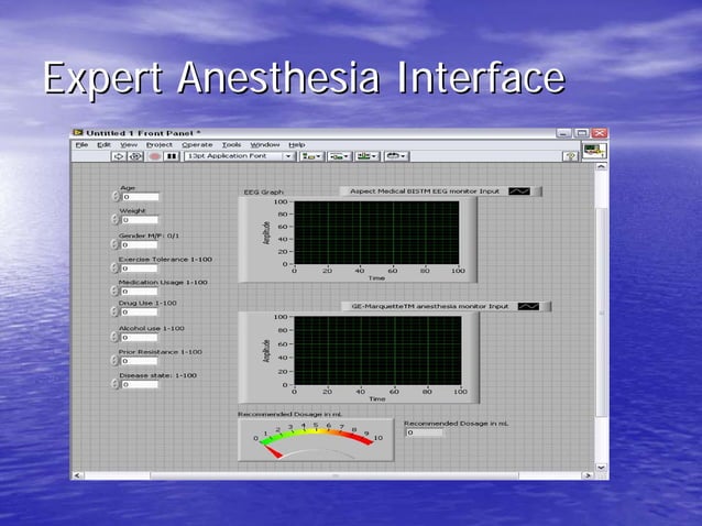 Expert Anesthesia Monitoring System Final Presentation | PPT
