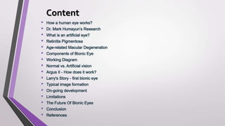 BionicEye | PPT