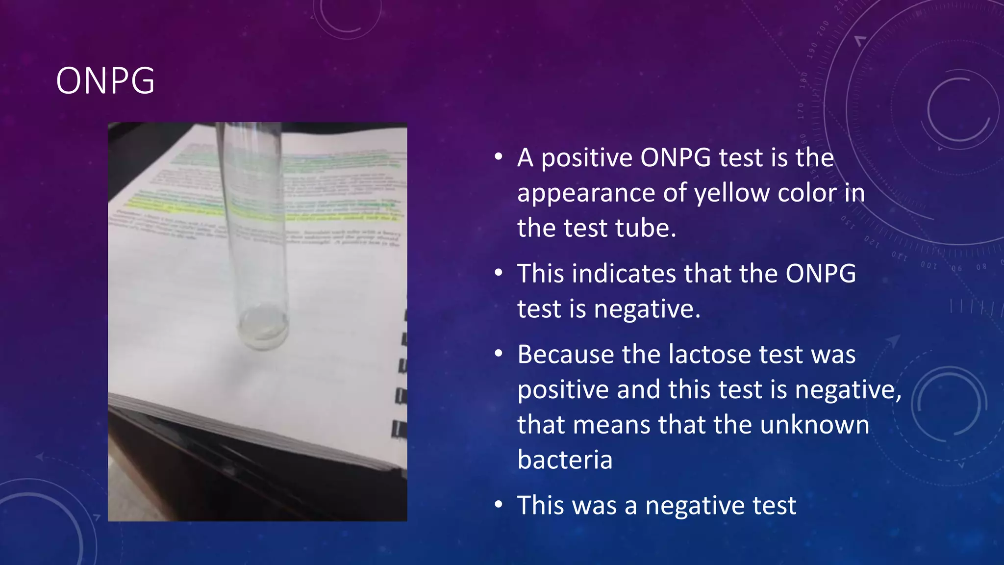 Microbiology Bacterial Unknown Project | PPTX