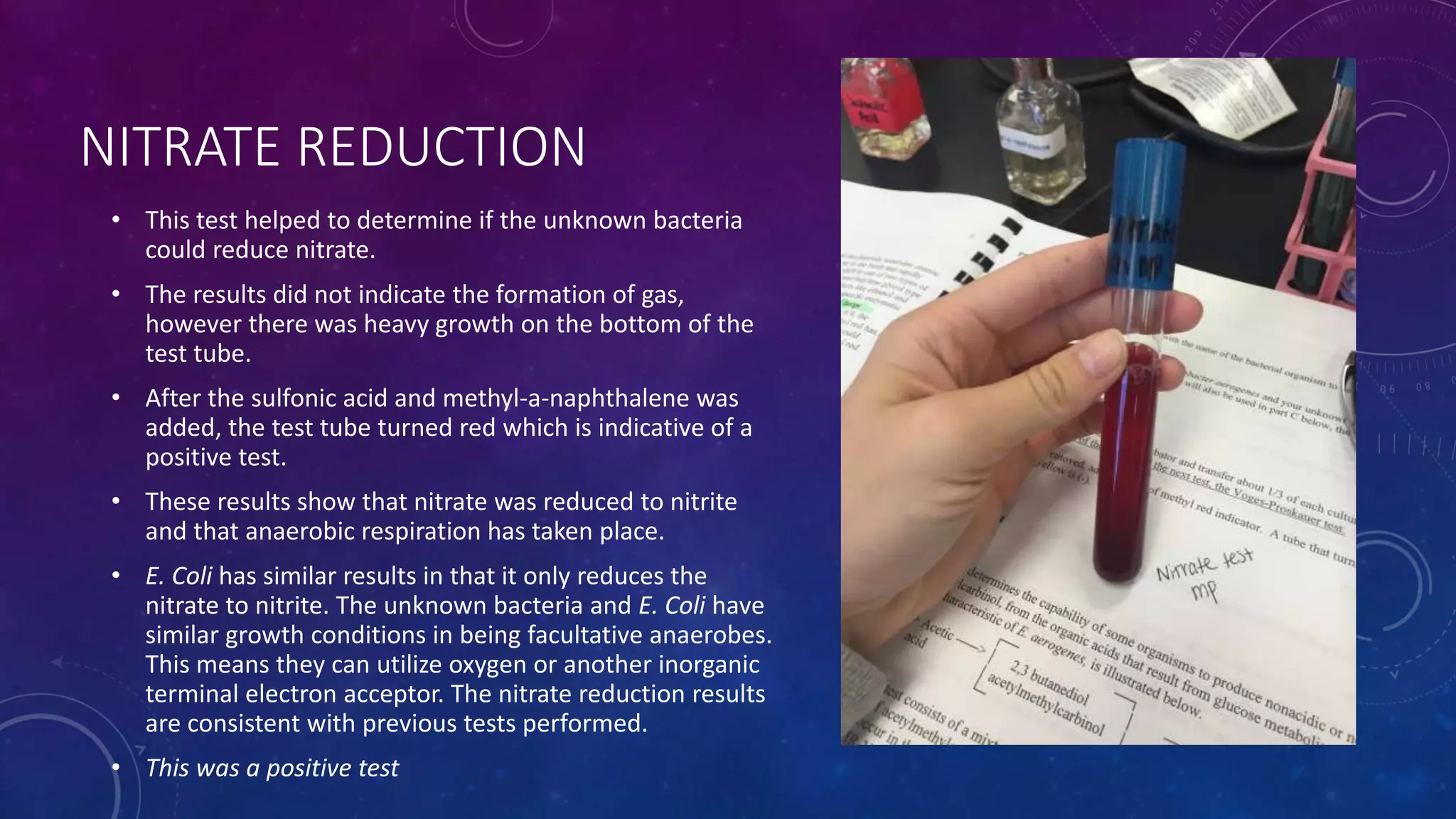 Microbiology Bacterial Unknown Project | PPTX