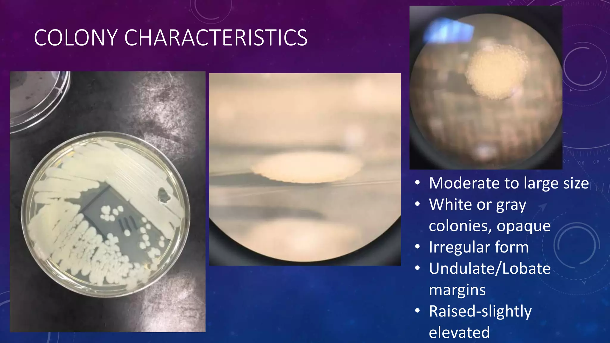 Microbiology Bacterial Unknown Project | PPTX