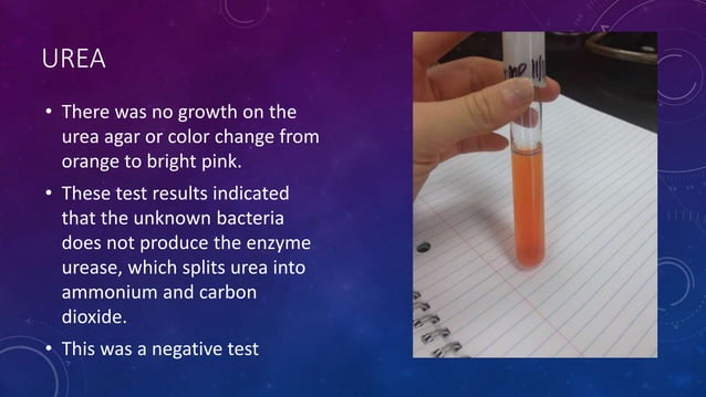 Microbiology Bacterial Unknown Project | PPTX