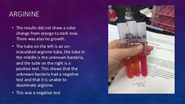 Microbiology Bacterial Unknown Project