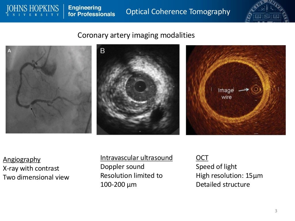 Guide to optical coherence tomography interpretation - armgilit