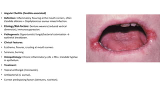Comprehensive Overview of Oral and Deep Fungal Infections: Diagnosis ...