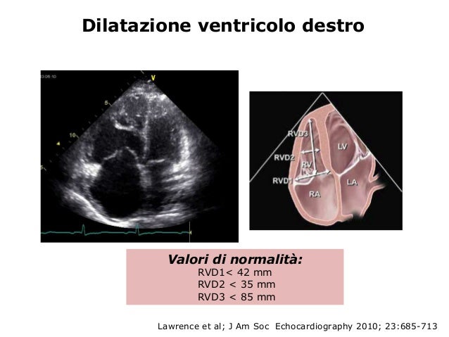 La valutazione ecocardiografica della funzione ventricolare destra