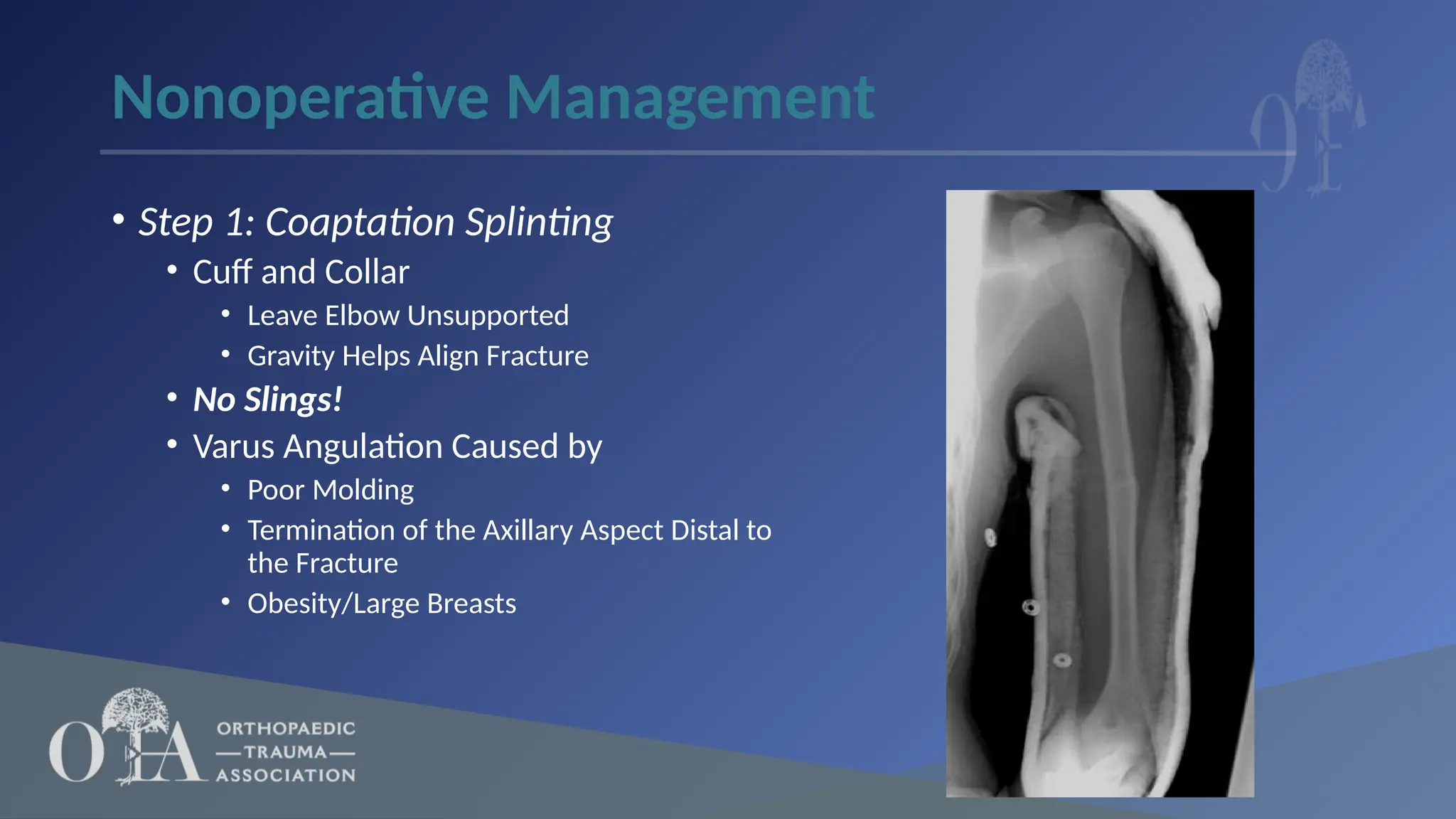 6_ Geriatric Fractures Around the Shoulder & Elbow - Copy.pptx