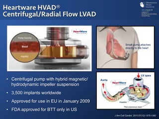 Advanced Heart Failure Therapies: Cardiac Transplantation and ...