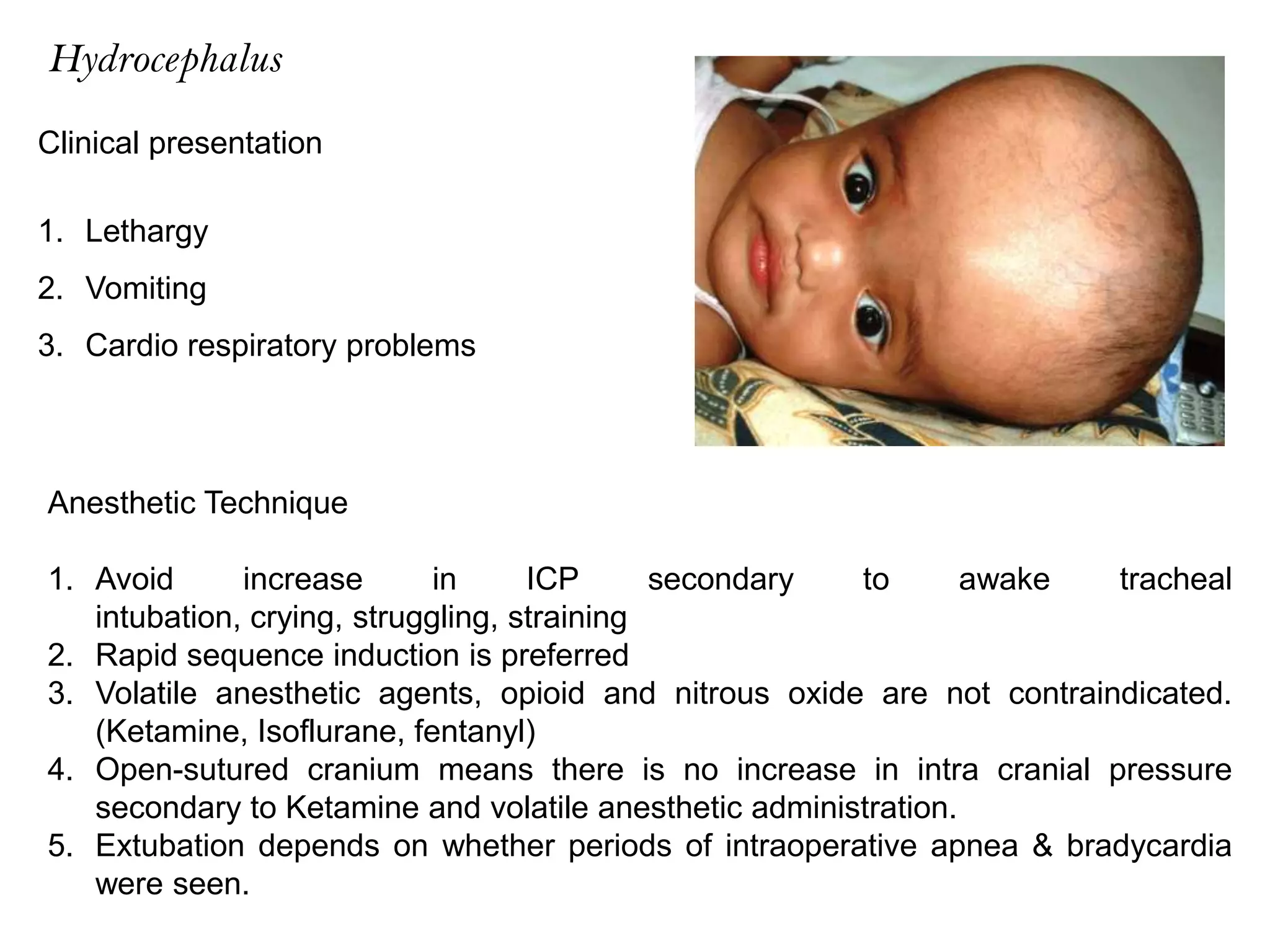 Hydrocephalus and Anesthesia | PPTX