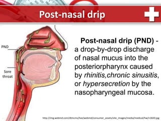 Post Nasal Drip Diagram