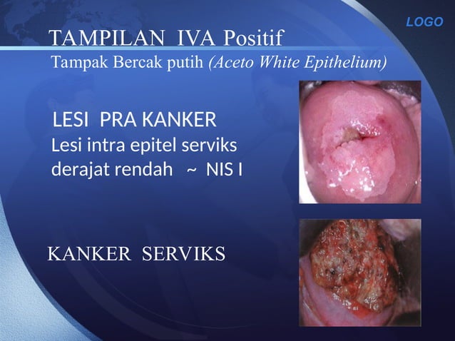 6_ IVA YKI - Laila Nov 2013.ppt inspiculo visual asam asetat | PPT