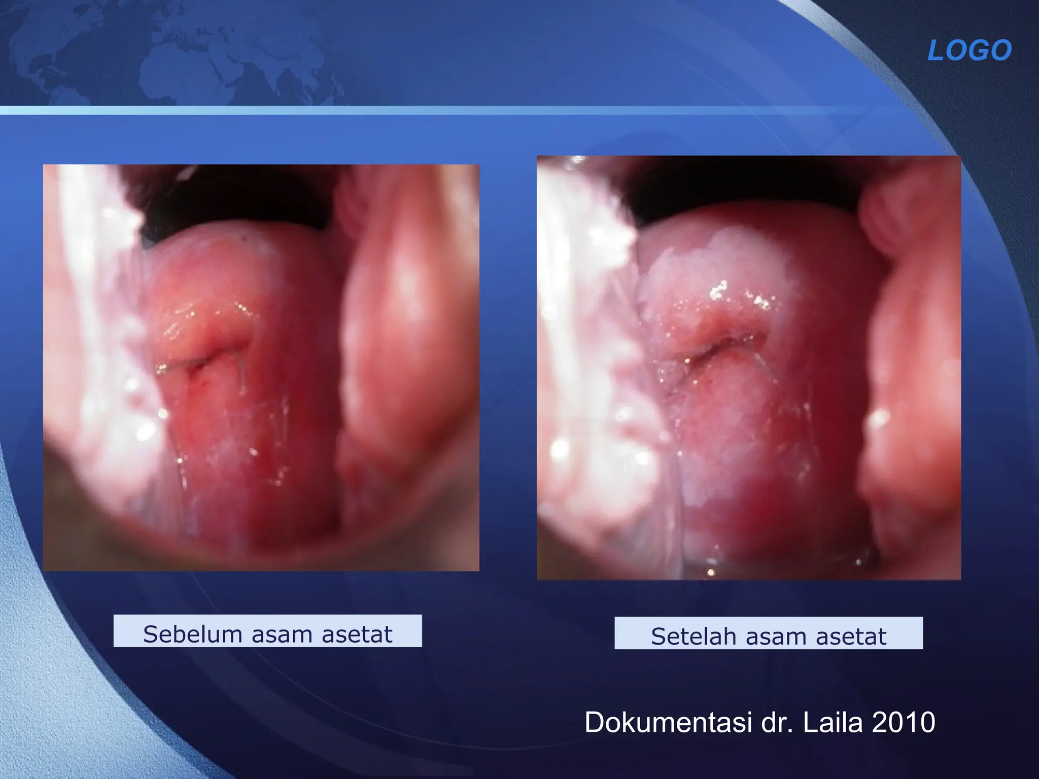 6_ IVA YKI - Laila Nov 2013.power point kesehatan | PPT