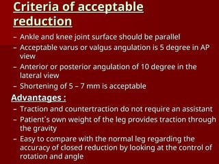 fracture_of_tibia_and_fibula modalities.ppt