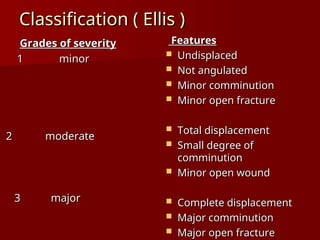 fracture_of_tibia_and_fibula modalities.ppt | Death, Injury, or ...