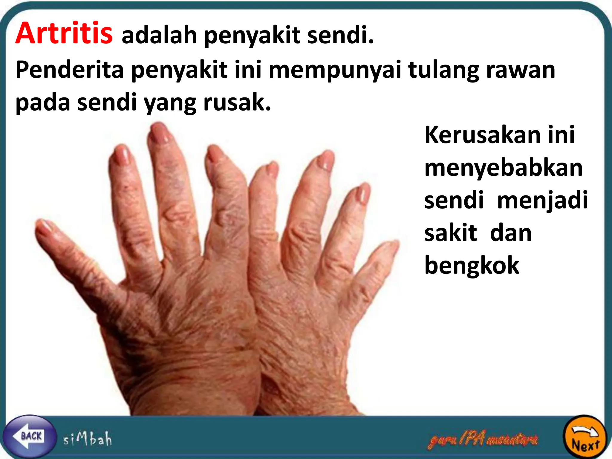 6 Kelainan Gerak yang terjadi pada tubuh manusia.pptx