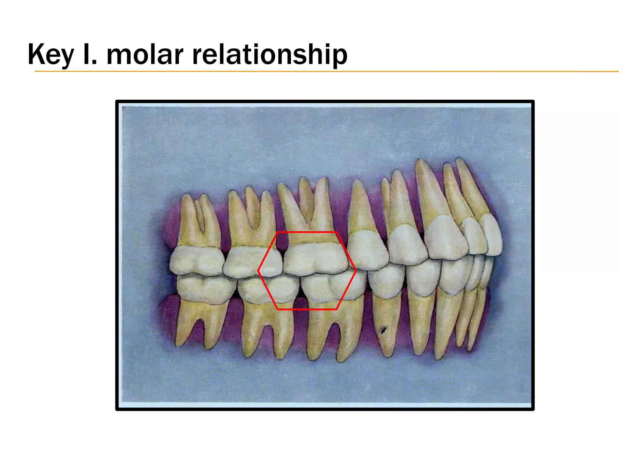6 keys of occlusion-converted.pdf