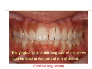 6 keys of occlusion-converted.pdf