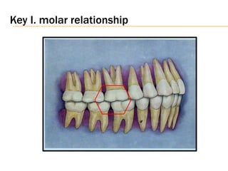 6 keys of occlusion-converted.pdf