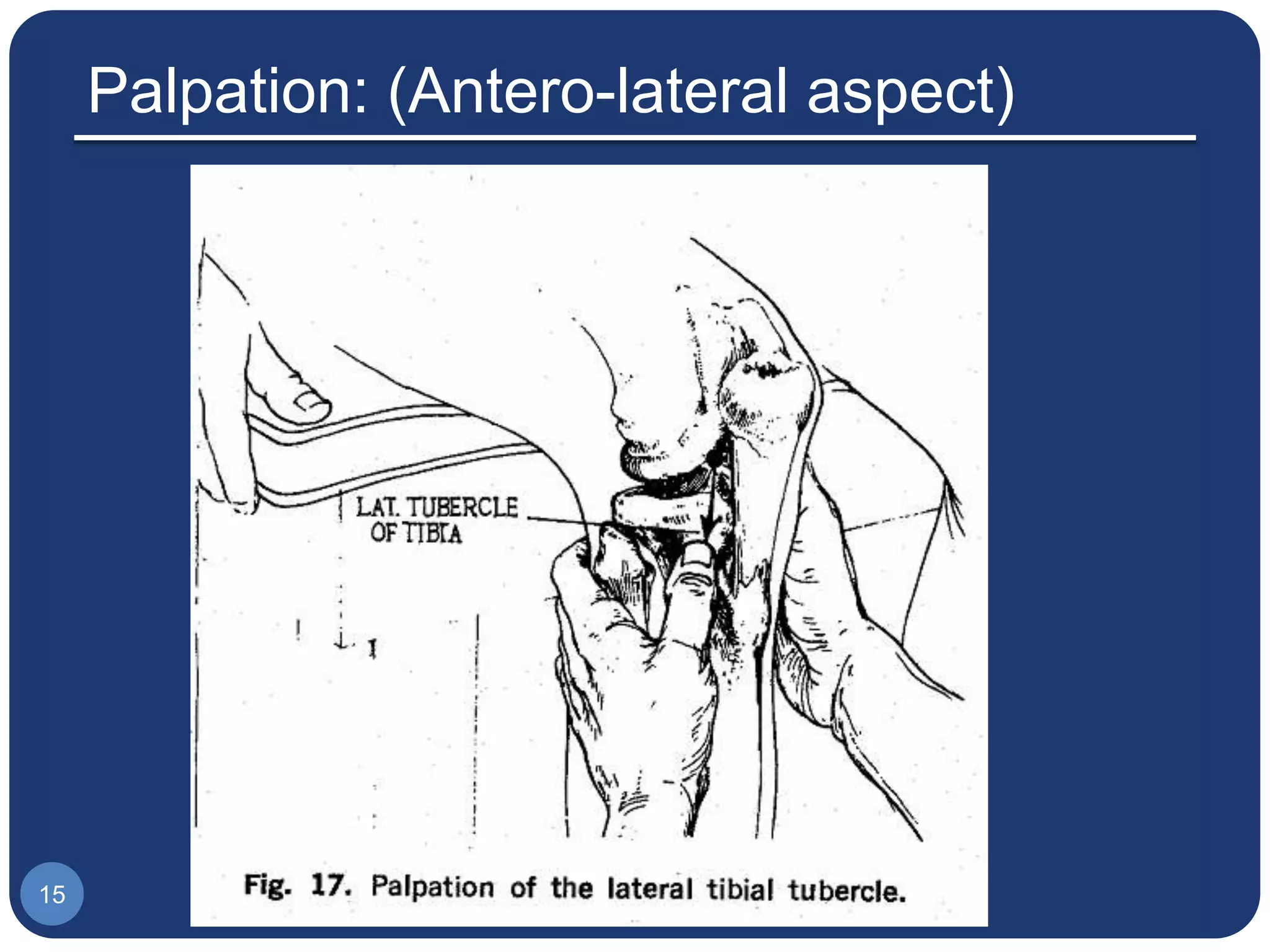 6 knee joint palpation | PPTX