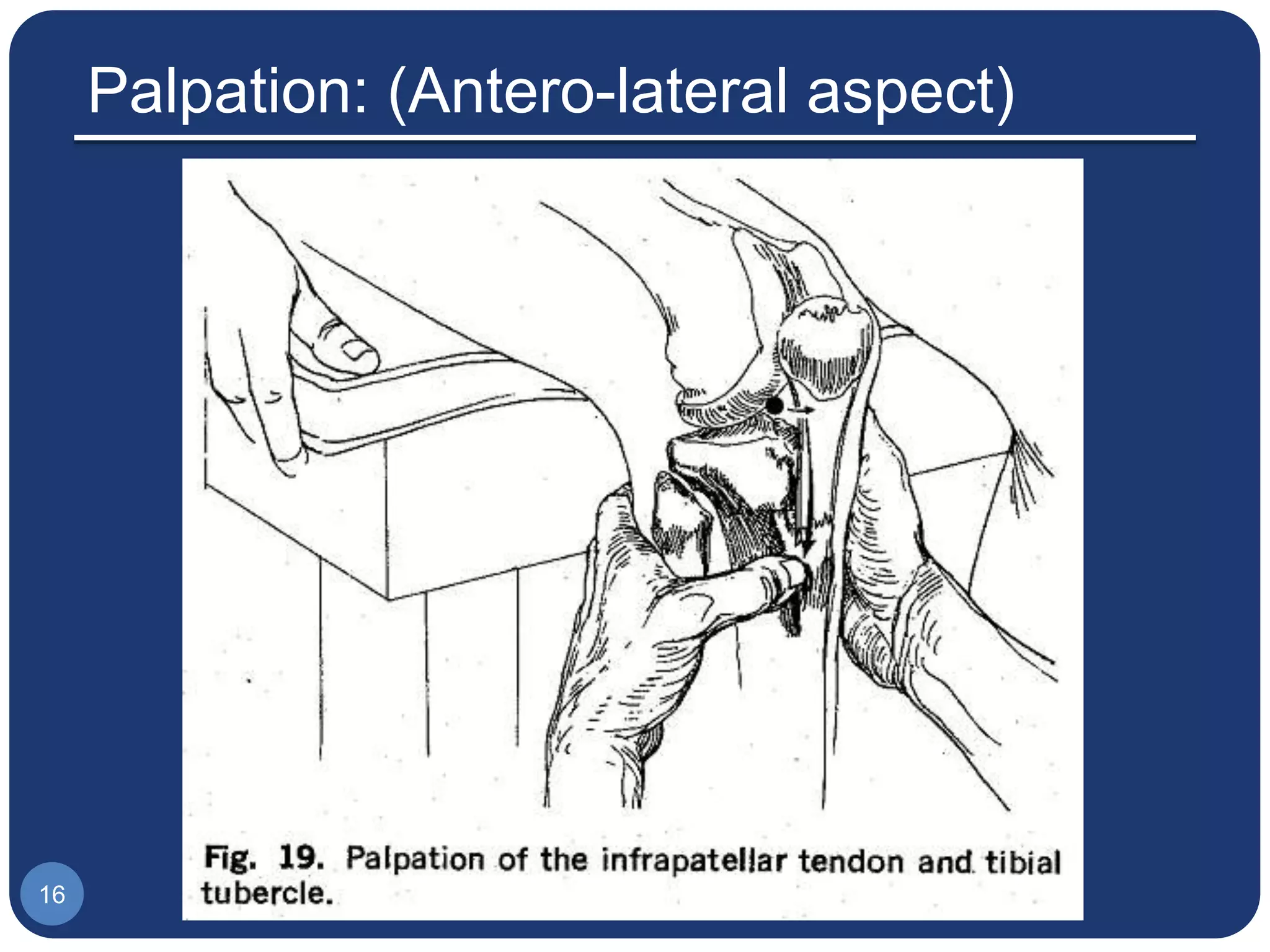 6 knee joint palpation | PPTX