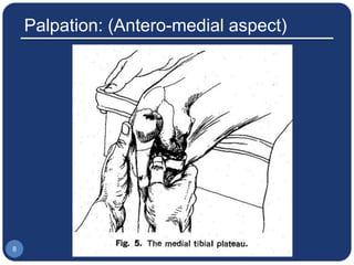 6 knee joint palpation | PPT