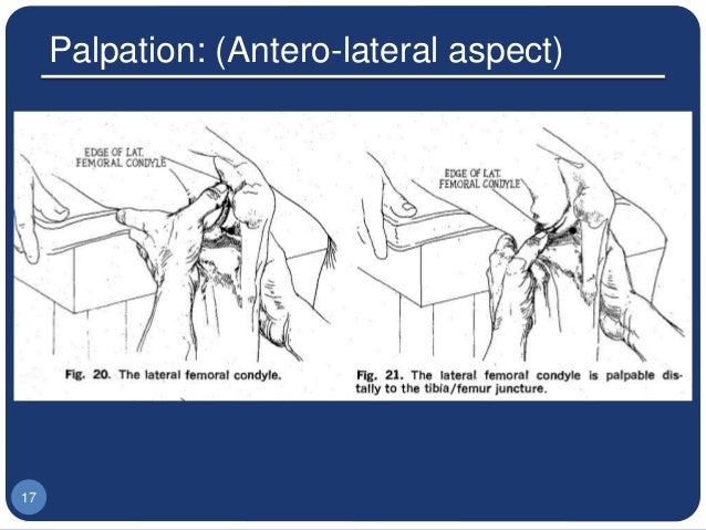 6 knee joint palpation