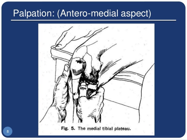 6 knee joint palpation