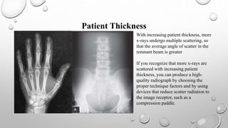 6 Lecture 6 Control of scatter radiation.pptx | Physics | Science