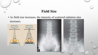 6 Lecture 6 Control of scatter radiation.pptx | Physics | Science