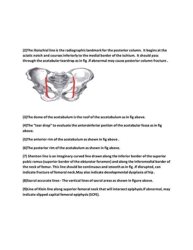 Various Pelvic lines | DOC