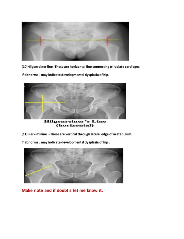 Various Pelvic lines | DOC