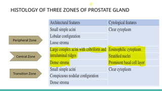 MORPHOLOGICAL PATTERNS OF PROSTATE TUMORS.pptx