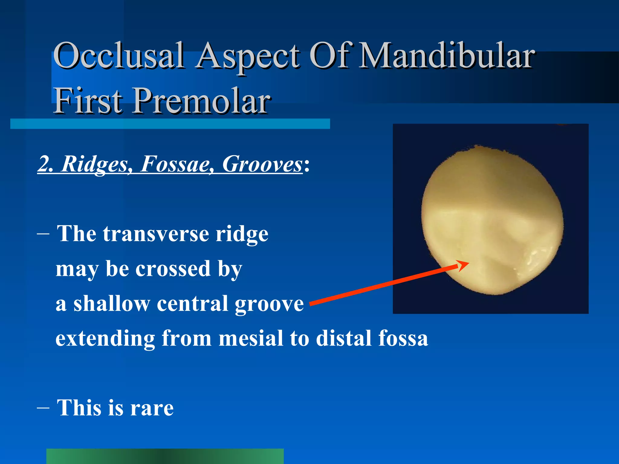 Mandibular Premolars | PPT