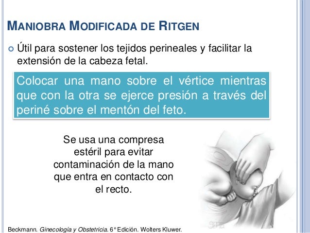 Mecanismo de trabajo de parto