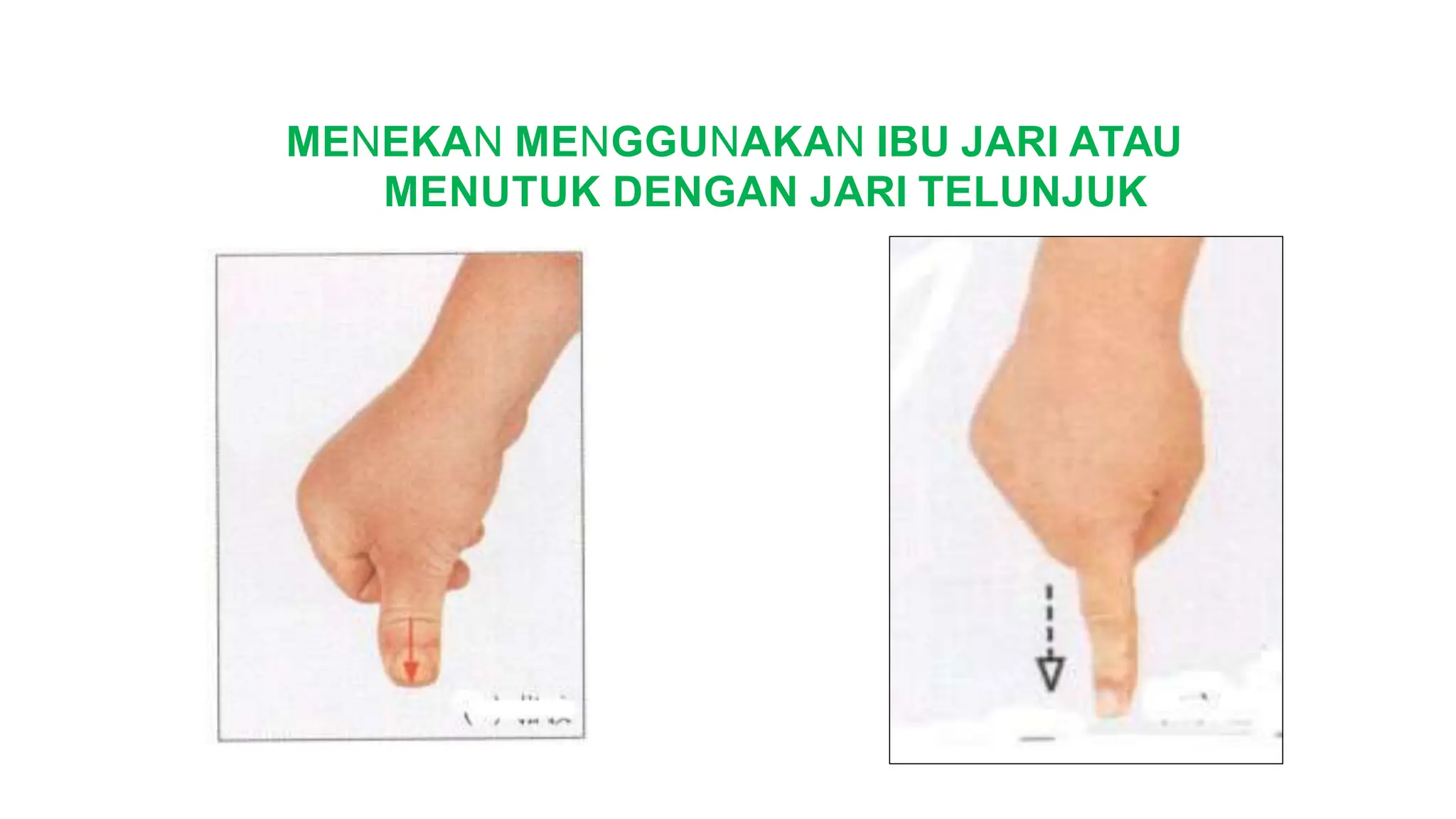 teknik dan mekanisme kerja akupresur.pptx
