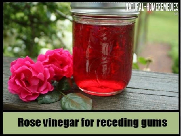 6 Natural Cures For Receding Gums
