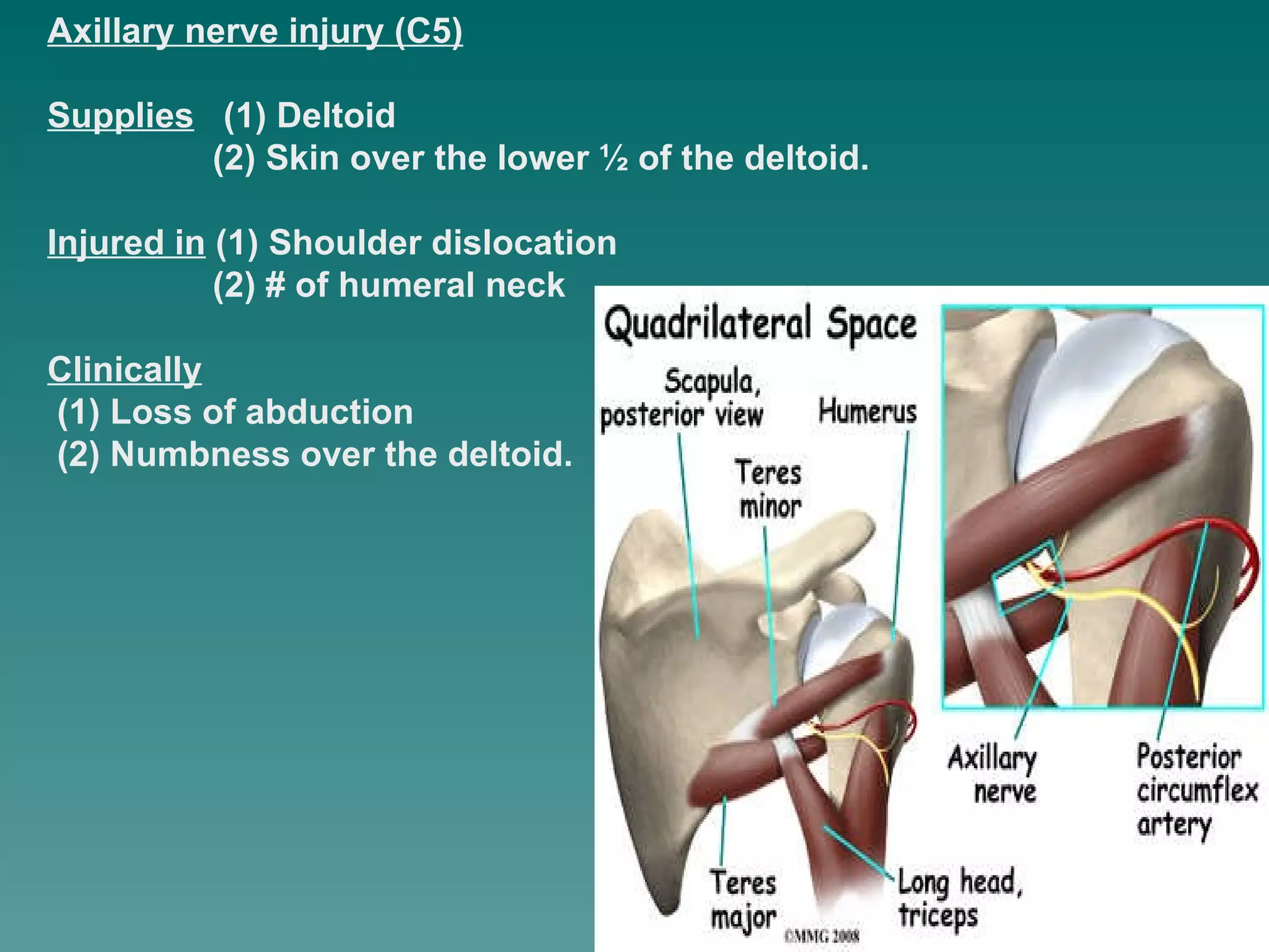 orthopedics,peripheral nerve injury.(dr.baxtiar rasul) | PPT