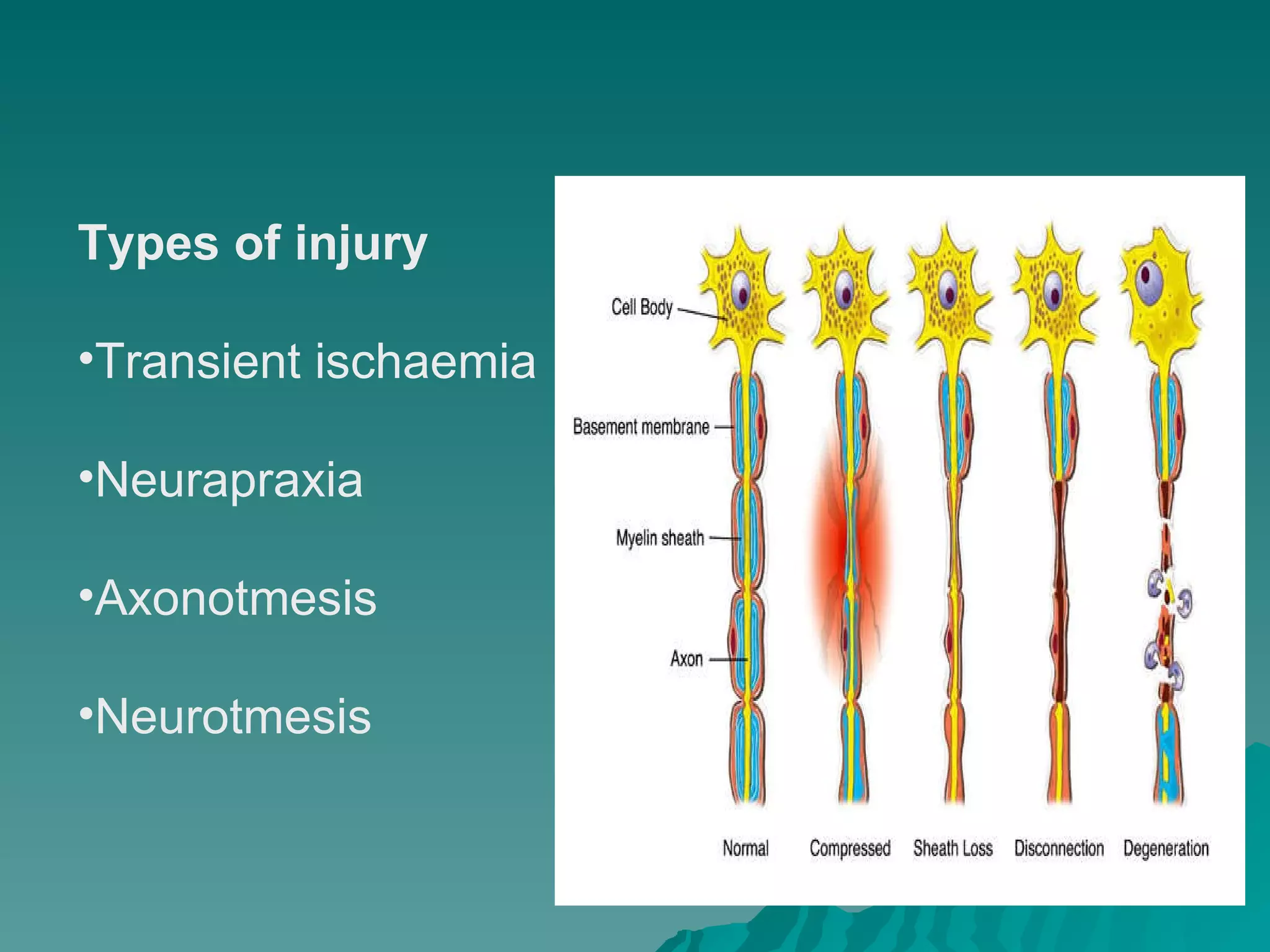 orthopedics,peripheral nerve injury.(dr.baxtiar rasul) | PPT