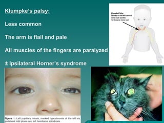 orthopedics,peripheral nerve injury.(dr.baxtiar rasul) | PPT