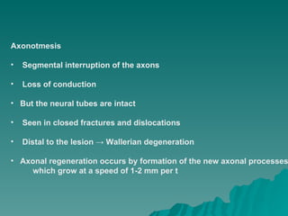 orthopedics,peripheral nerve injury.(dr.baxtiar rasul) | PPT