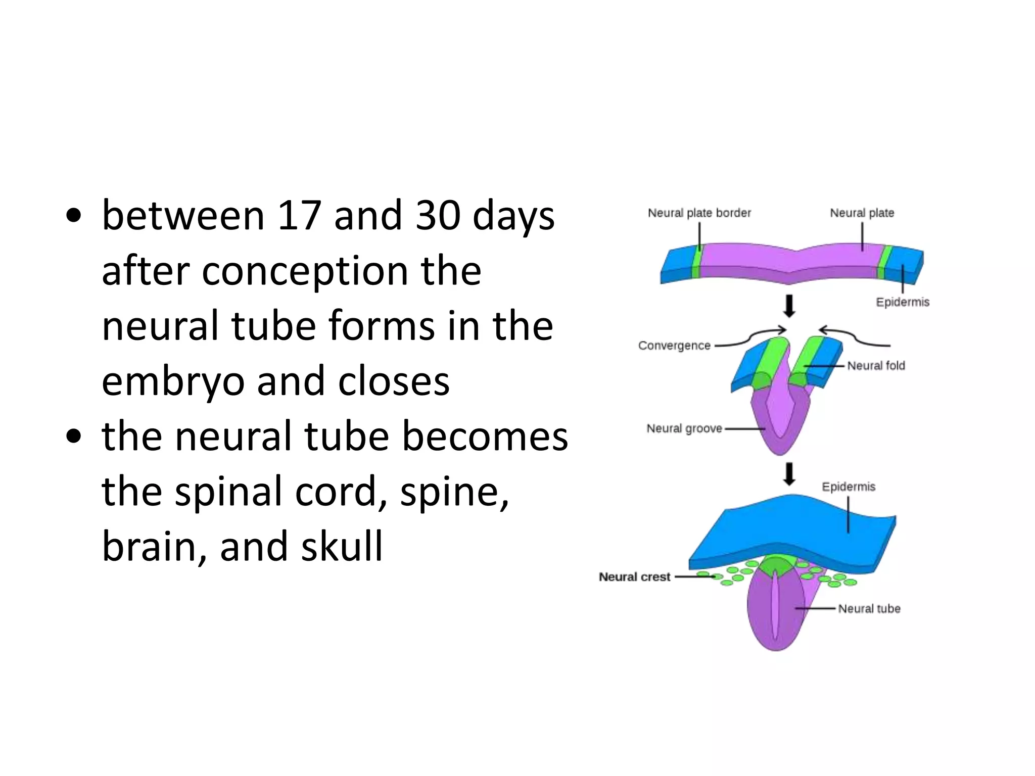 6Neural tube defects.pptx