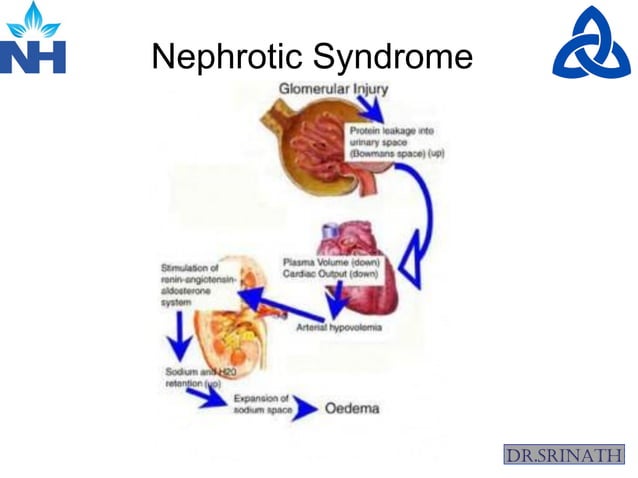 Nephritic vs nephrotic syndrome6npoqoa8qakc (1).pdf | Blood Disorders ...