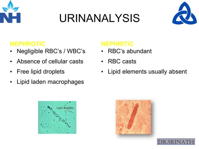 Nephritic vs nephrotic syndrome6npoqoa8qakc (1).pdf | Blood Disorders ...