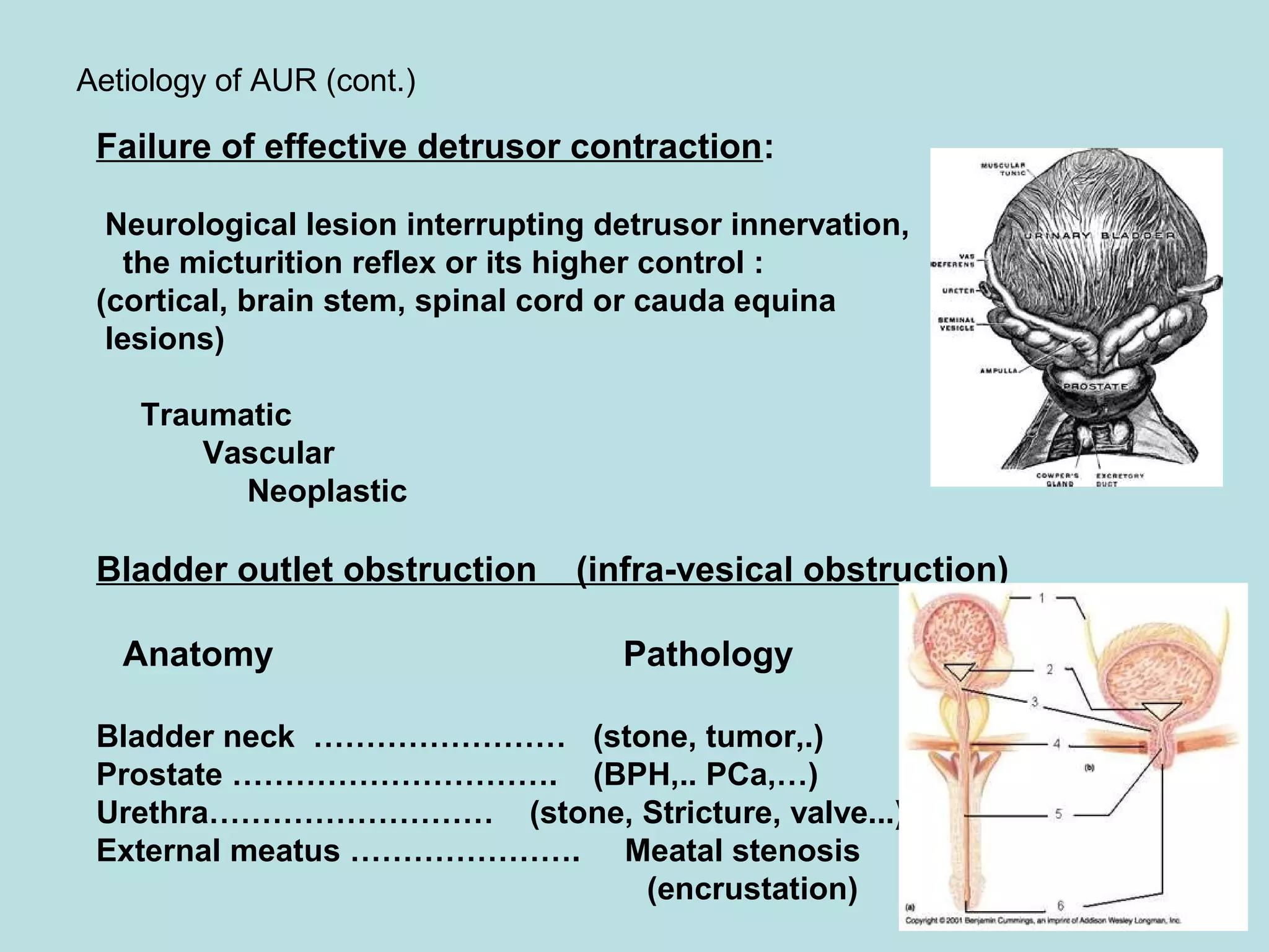 6 obstructive uropathy,acute urinary retention,hematuria | PPT