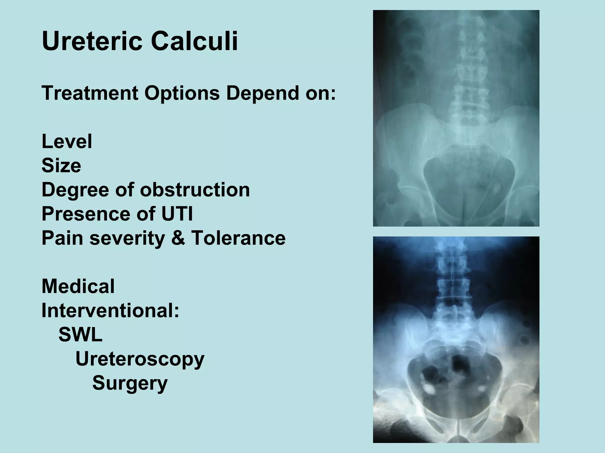 6 obstructive uropathy,acute urinary retention,hematuria | PPT