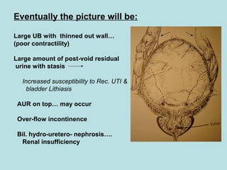 6 obstructive uropathy,acute urinary retention,hematuria | PPT