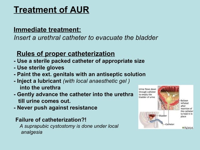 6 obstructive uropathy,acute urinary retention,hematuria | PPT | Cancer ...