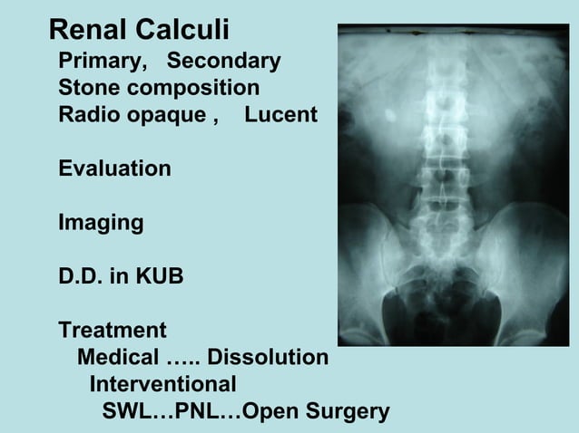 6 obstructive uropathy,acute urinary retention,hematuria | PPT | Cancer ...