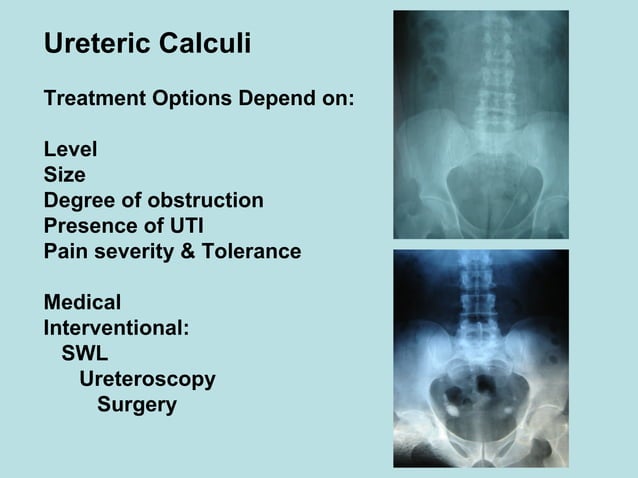 6 obstructive uropathy,acute urinary retention,hematuria | PPT