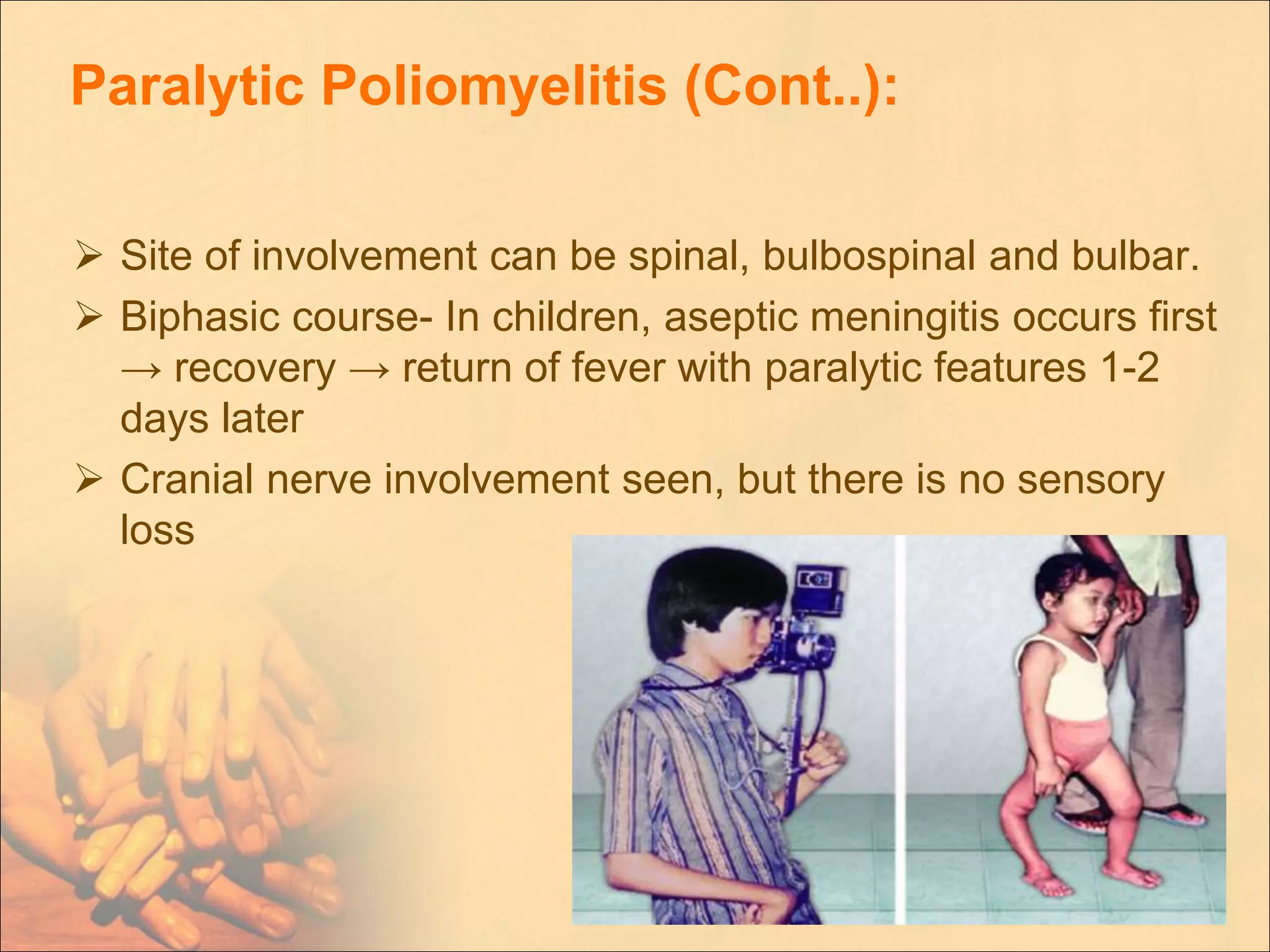 6 october -Poliomyelitis -.ppt